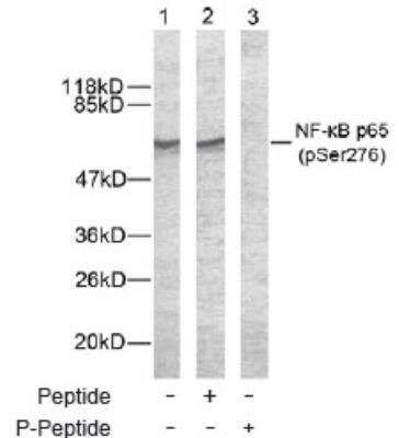 RelA/NFkB p65 [p Ser276] Antibody (NB100-82086): Novus Biologicals